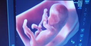 Ultrassom 5D traz inovação na saúde de gestantes e bebês | Jornal